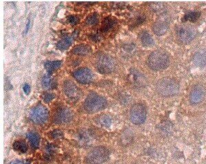 HLA-C (MHC I) [MD363] - Medaysis